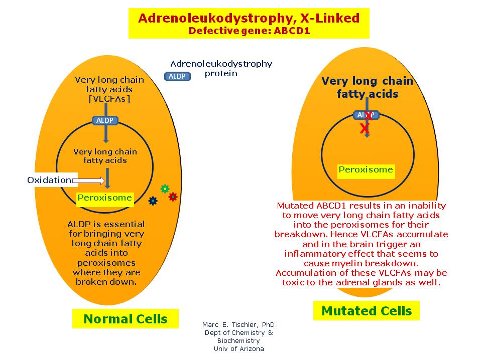 Adrenoleukodystrophy, X-Linked | Hereditary Ocular Diseases